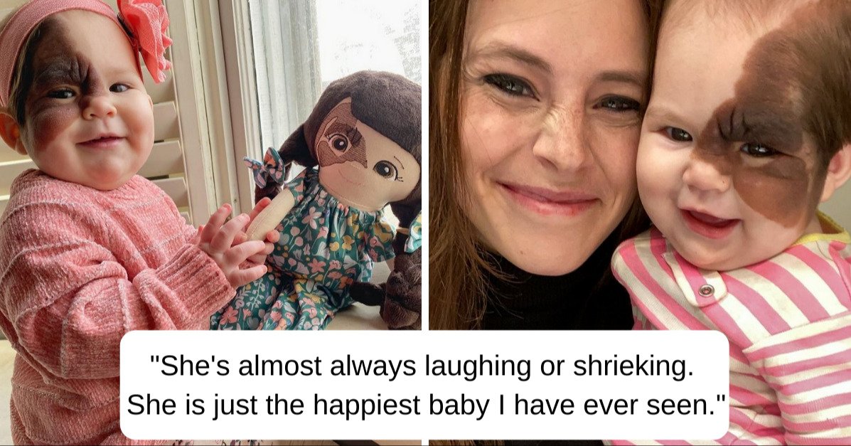 Mom Hopes To Show That ‘Differences’ Are Beautiful By Sharing Daughter ...